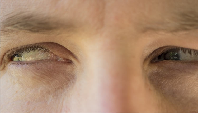 Qual é o Significado de Inveja na Bíblia?